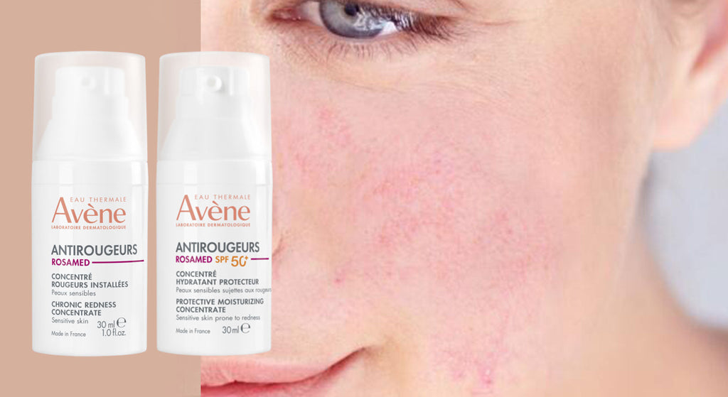 Avène bij Couperose en Rosacea - Productadvies - Dermatheek